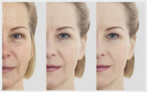 Changements physiologiques du vieillissement - La Gériatrie